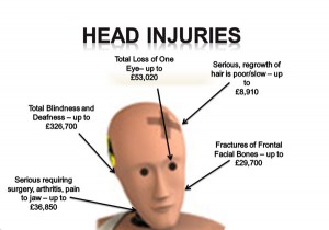 Signs of head trauma - fertthenew